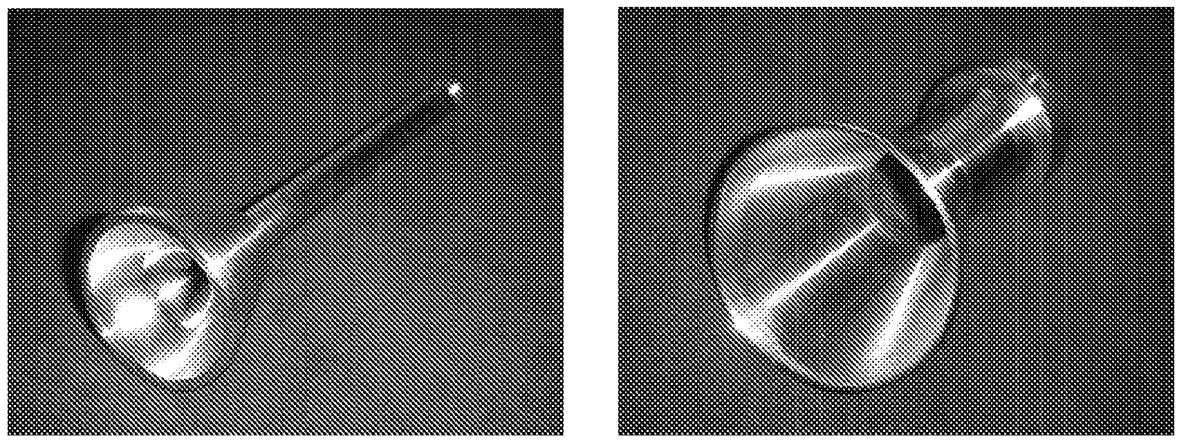 WO2008019419A1 - A clamp to restore the foreskin - Google Patents