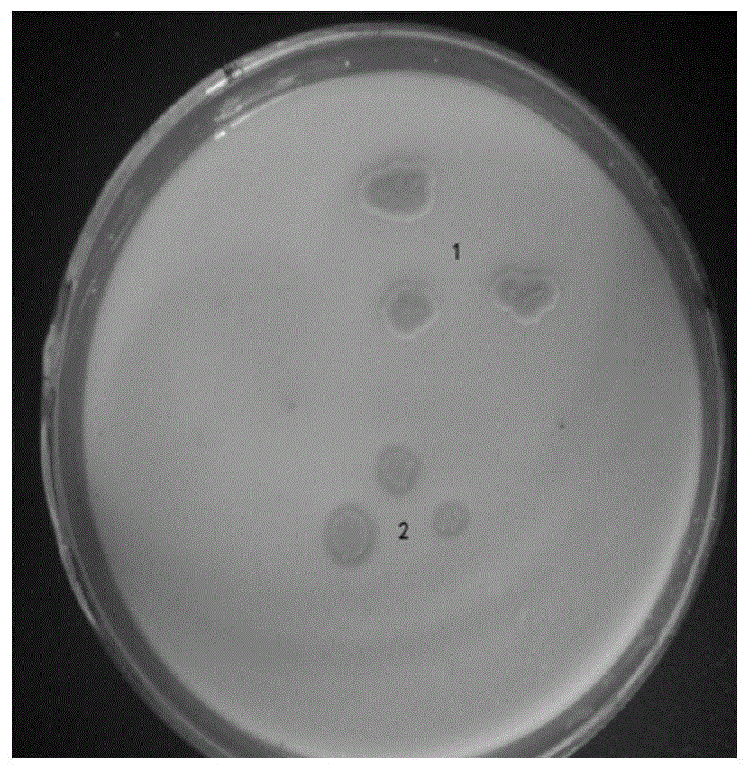CN106916875B - Culture medium for identifying acetobacter and ...