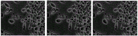CN113450354A - Trichomonas detection method based on convolutional ...