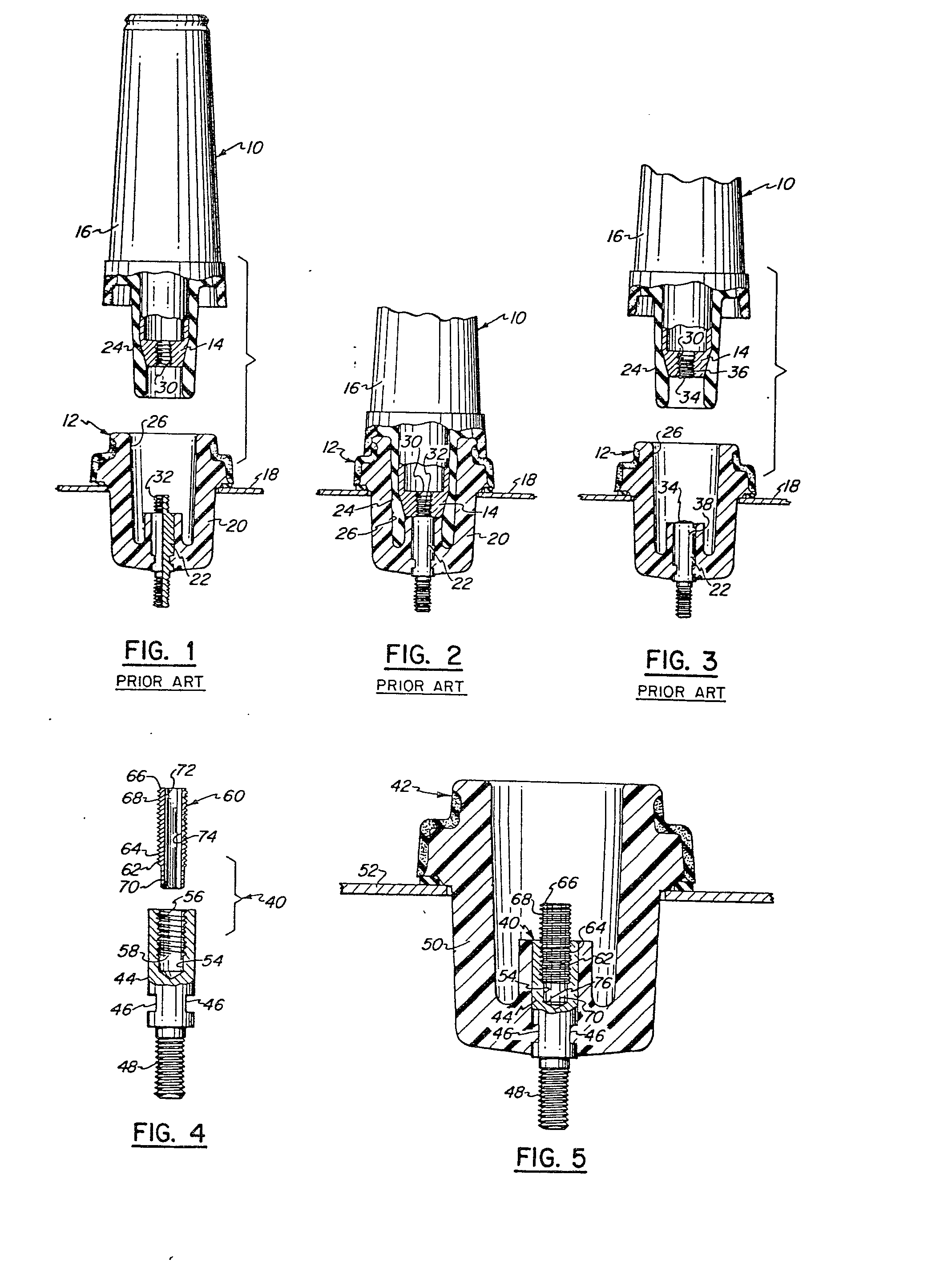 Bushing Patents Sketch Coloring Page