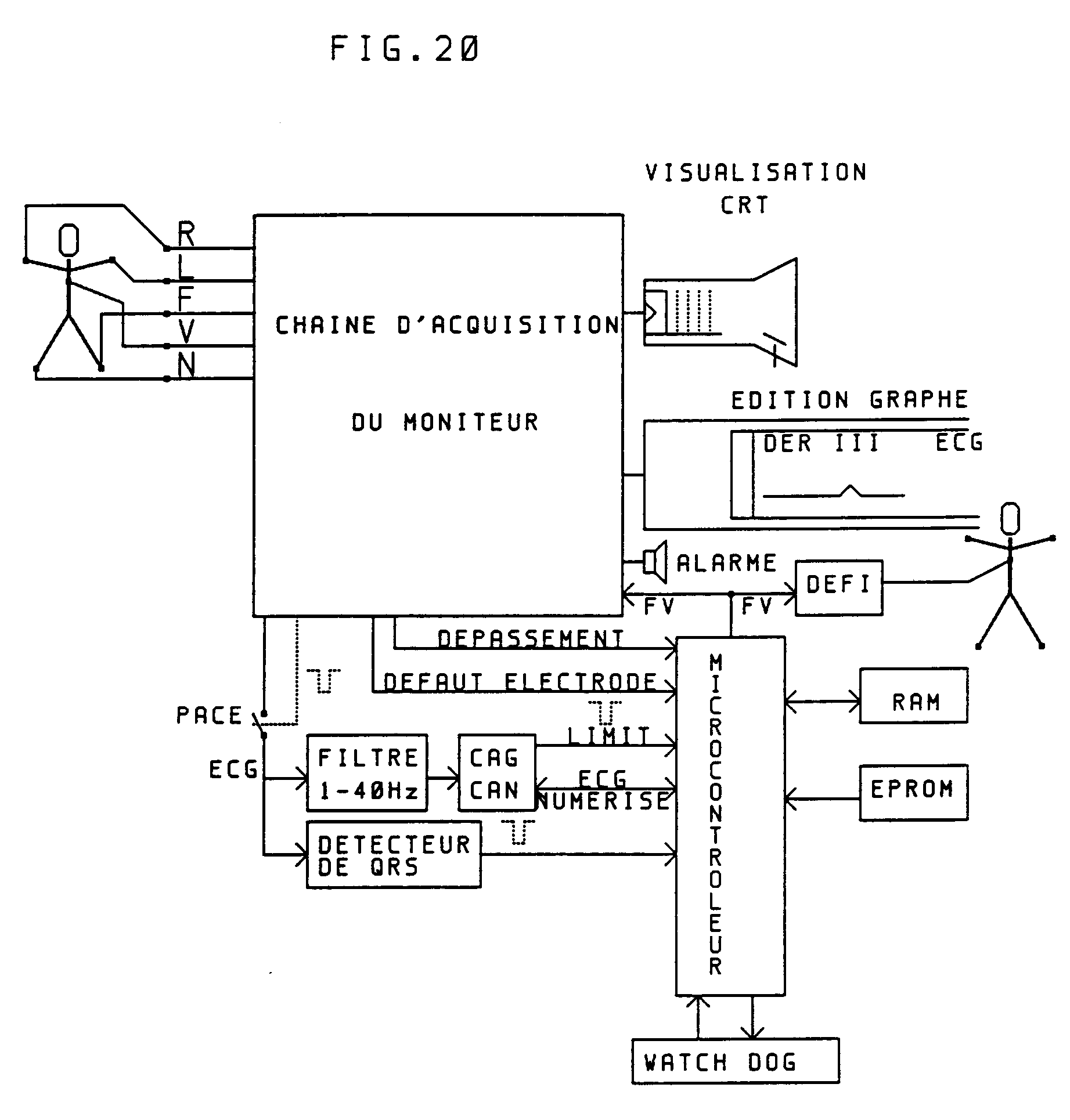 SchÃ©ma synoptique d'un ecg