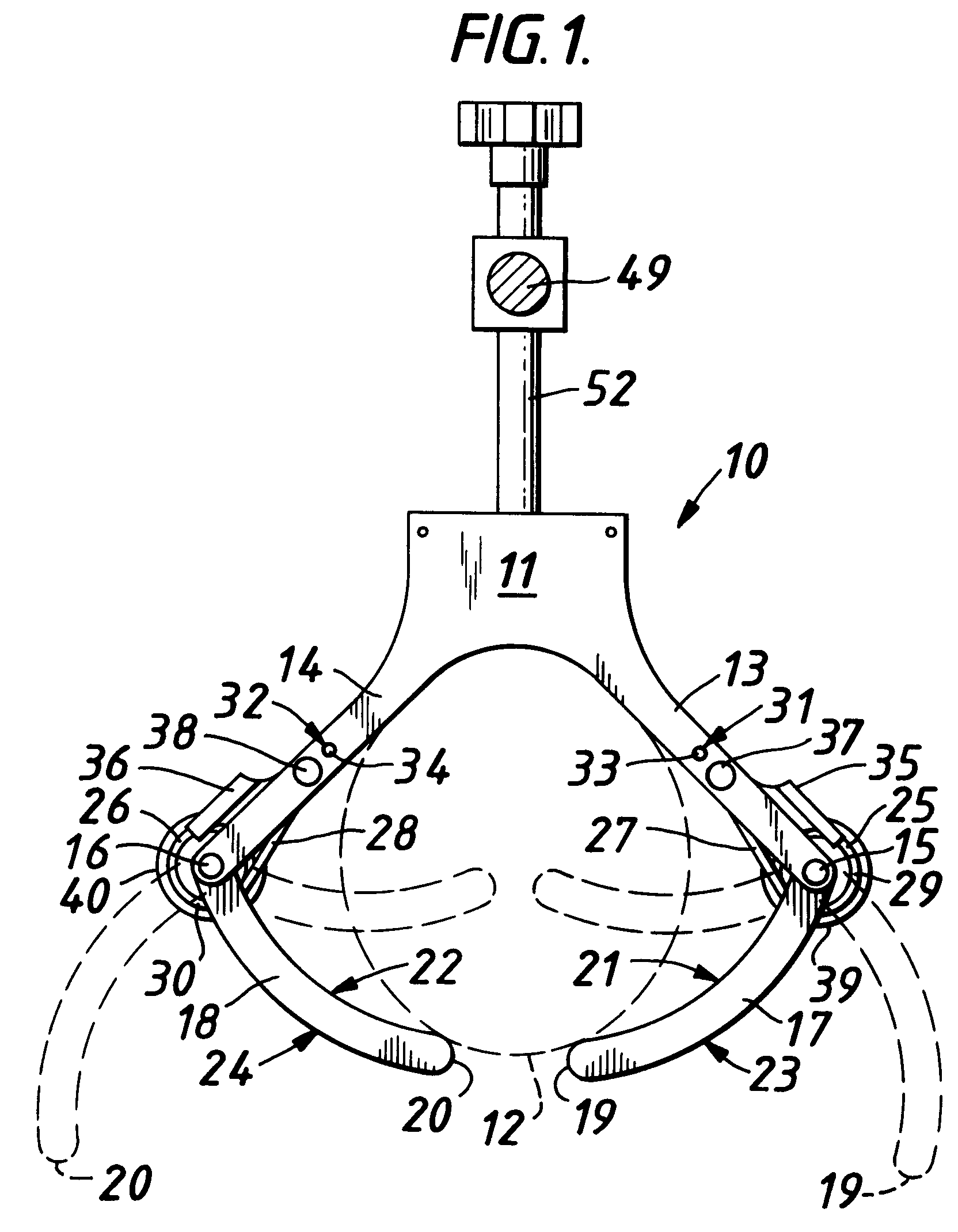 Patent EP0564176A1 - Ankle clamp - Google Patents