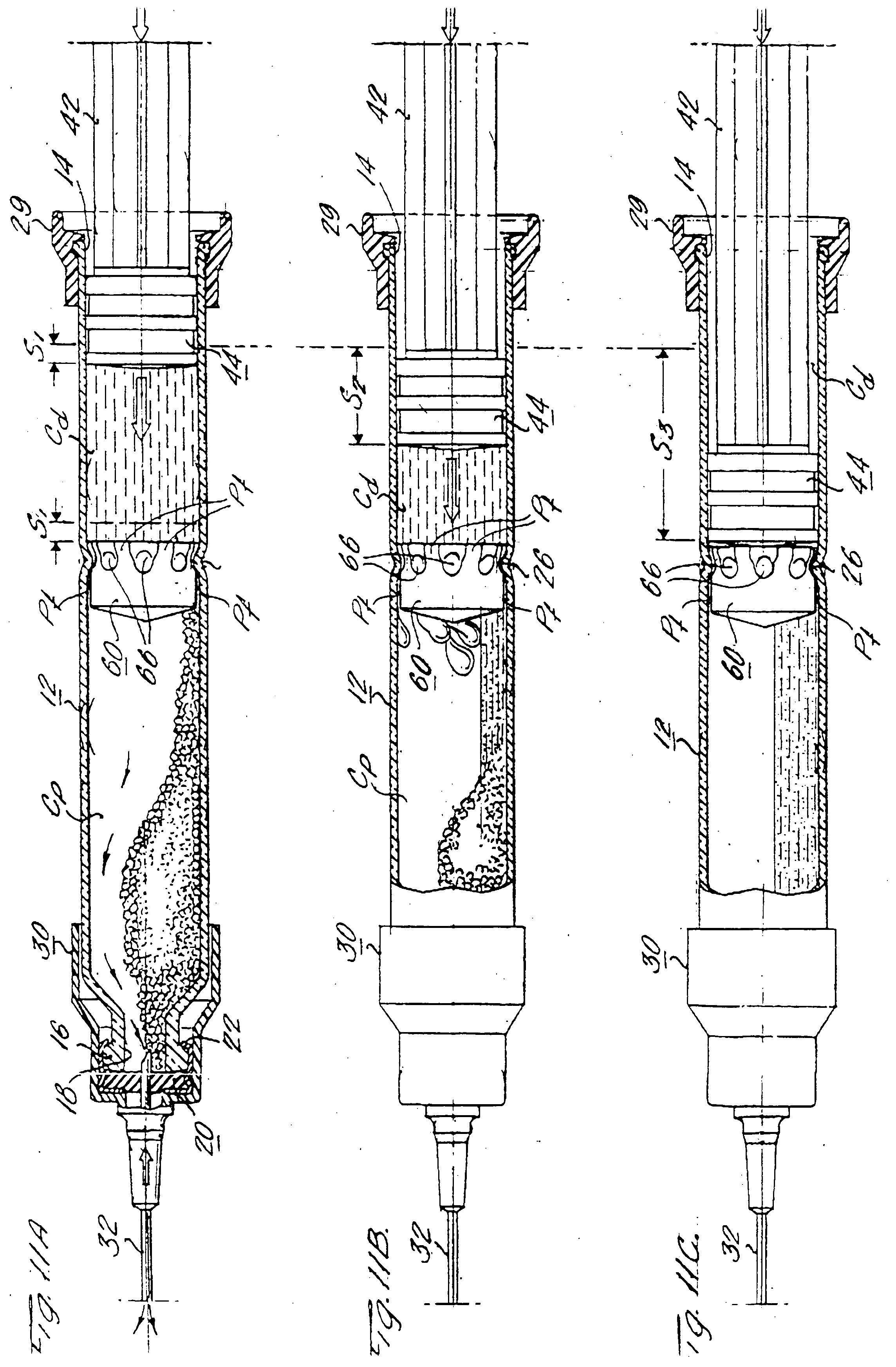 Syringe Patents Patent Chamber Claims Sketch Coloring Page