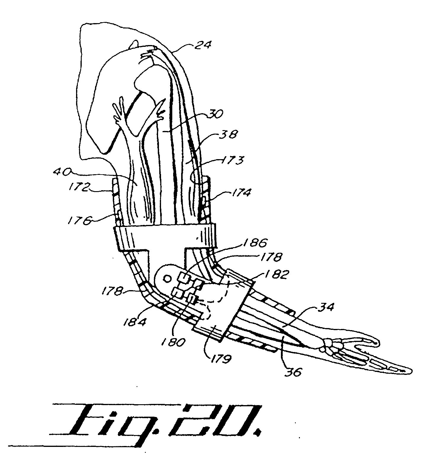 Drawing Patents Patent Prosthetic Sketch Coloring Page