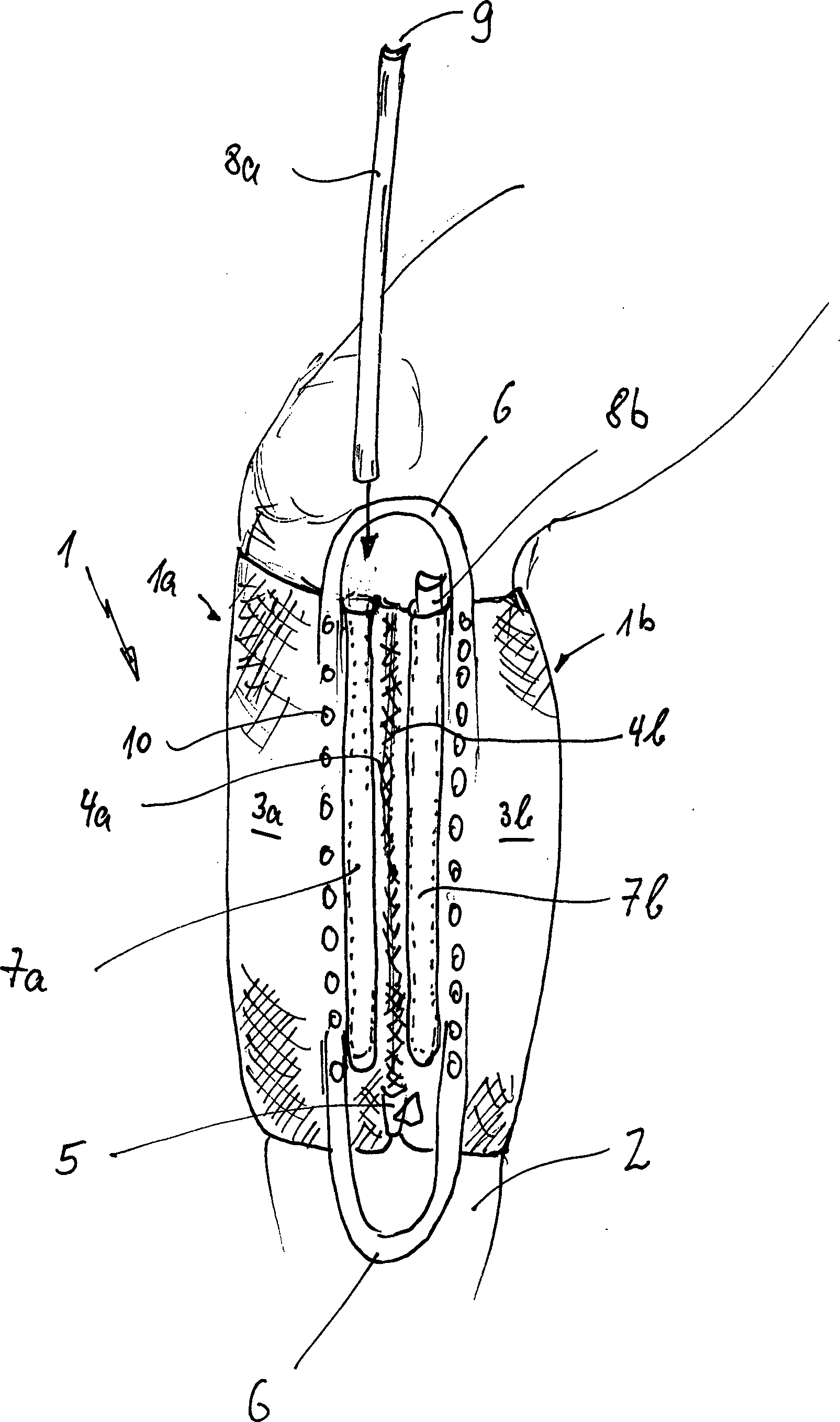 DE202008015120U1 - wound zipper - Google Patents
