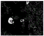 CN113450354A - Trichomonas detection method based on convolutional ...