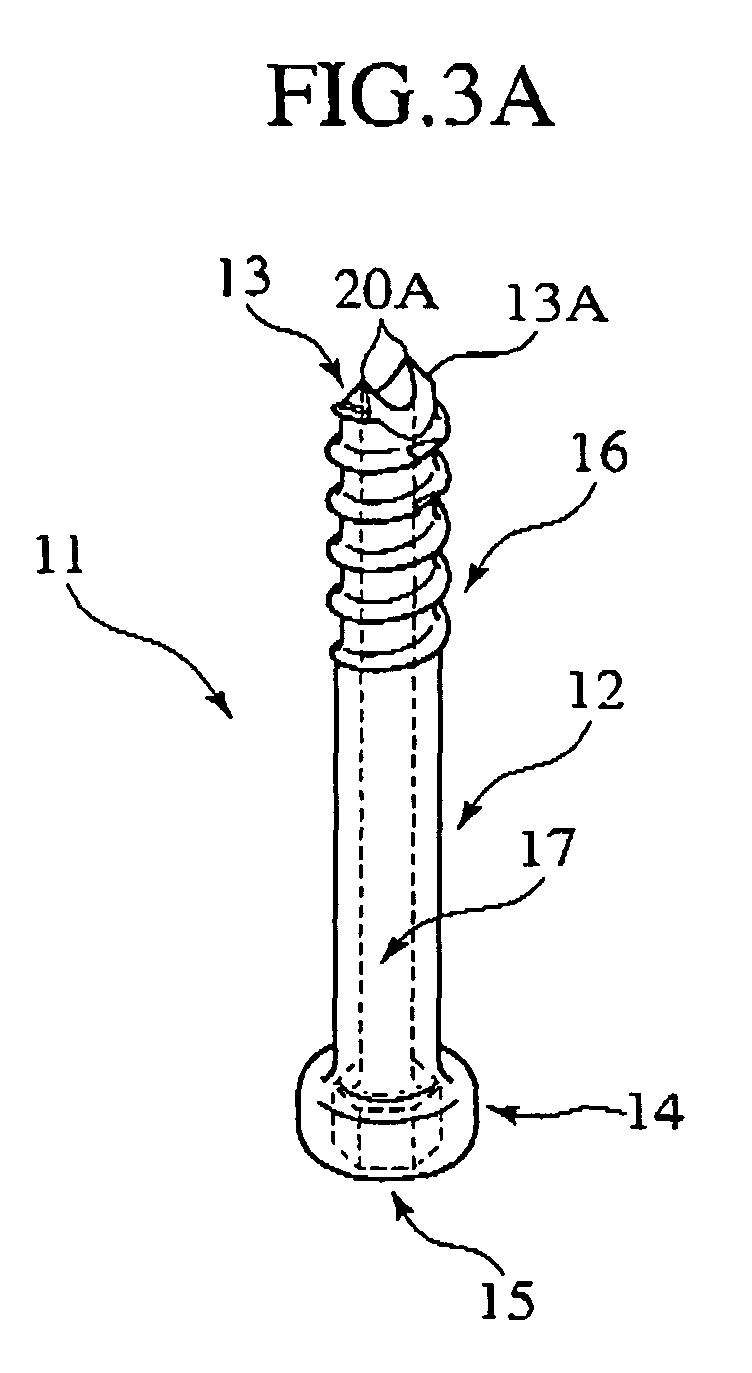 EP1360939A2 - Screw for fixing atlantoaxial joint - Google Patents