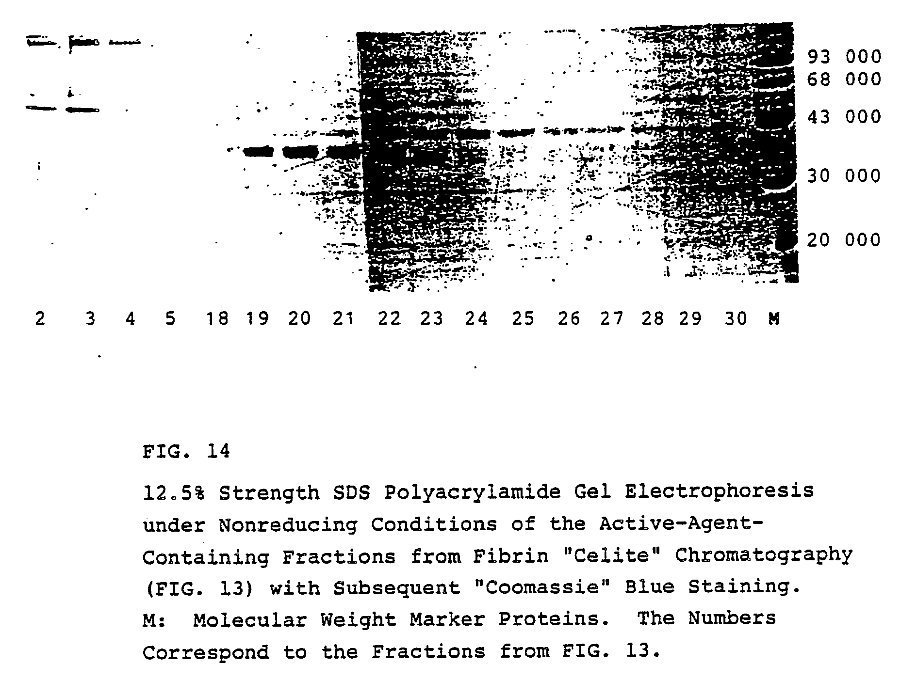 EP0383417A1 - Vampire bat salivary Plasminogen activator vPA-alpha 1 ...