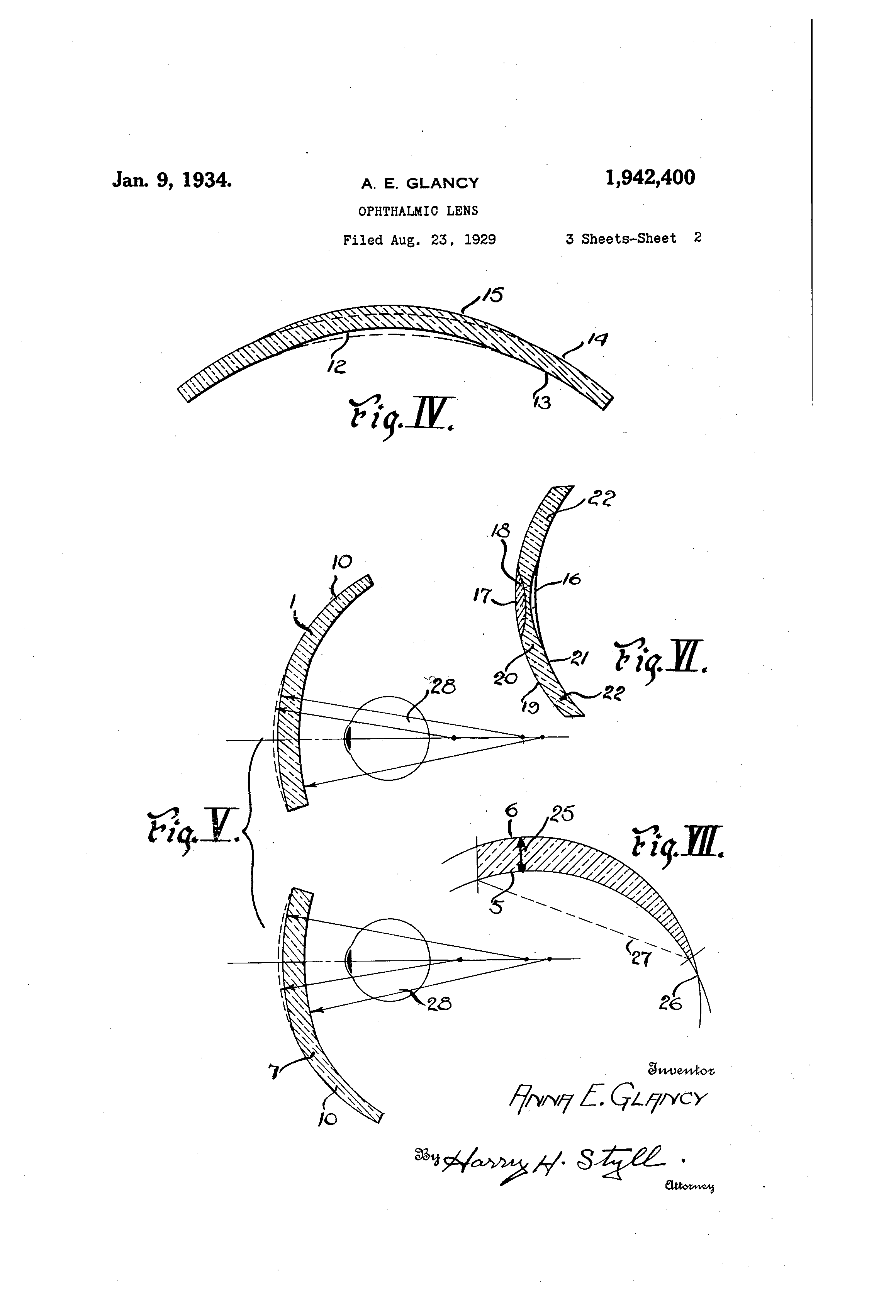 Patent Lens