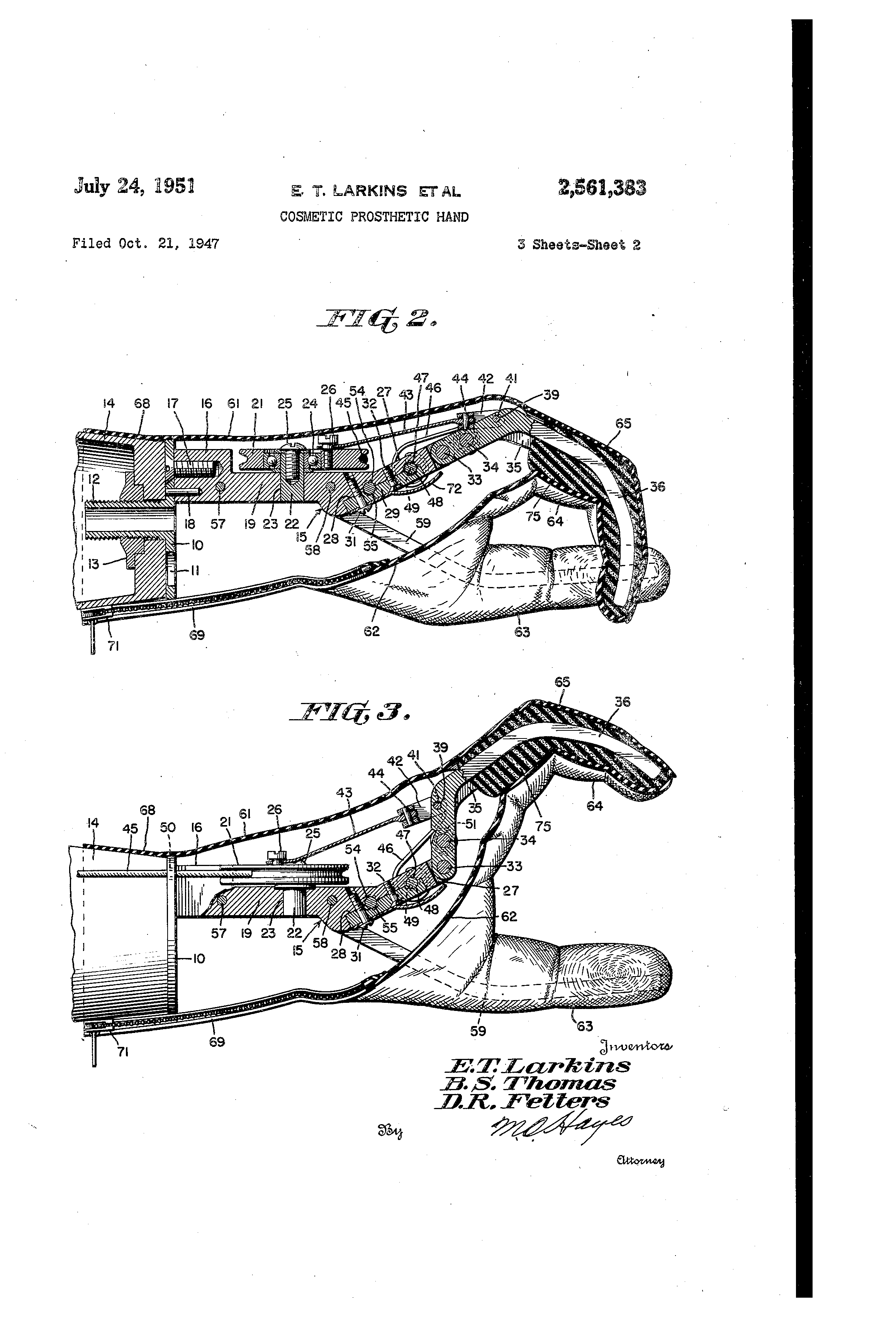 Prosthetic Patent Hand Patents Cosmetic Sketch Coloring Page