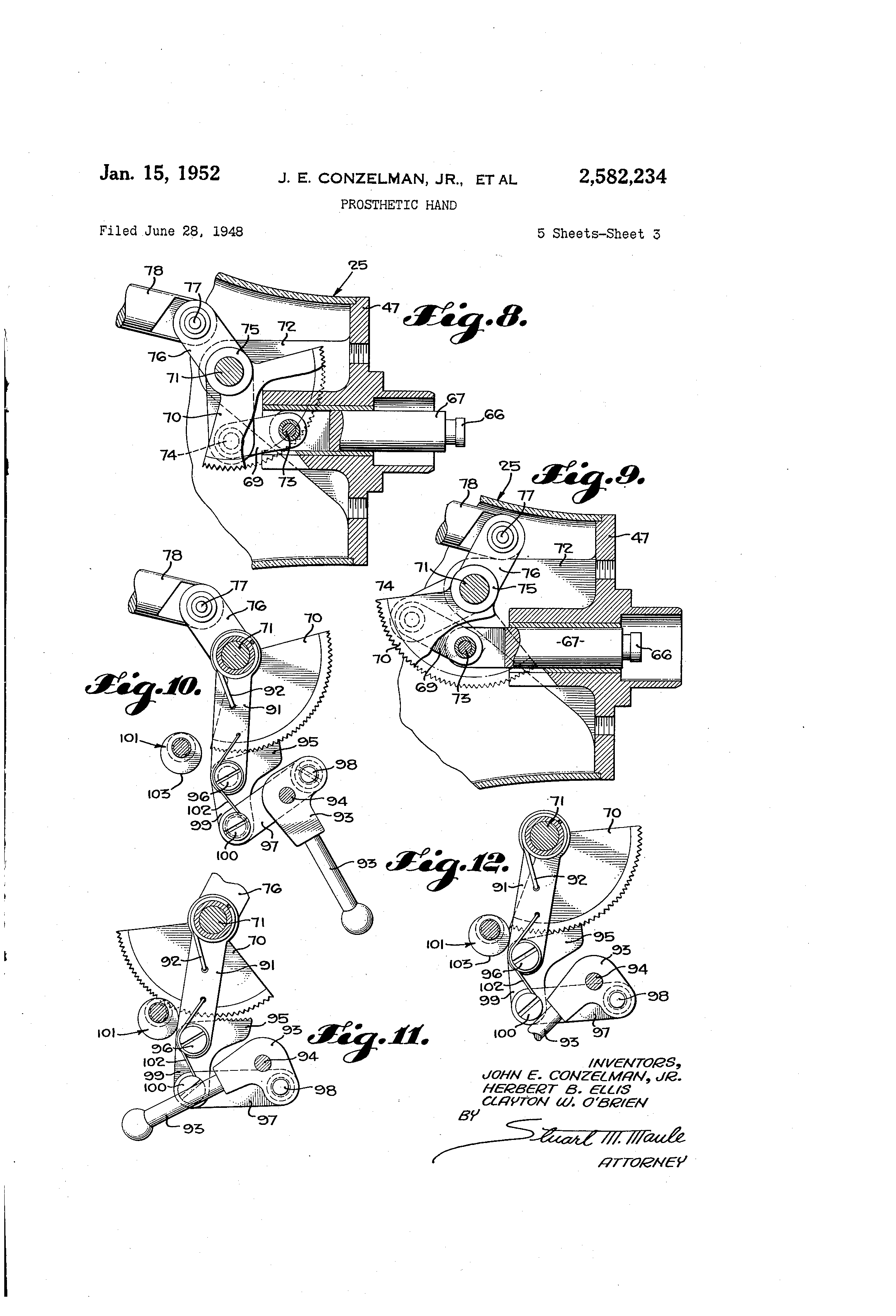 Patents Prosthetic Hand Sketch Coloring Page