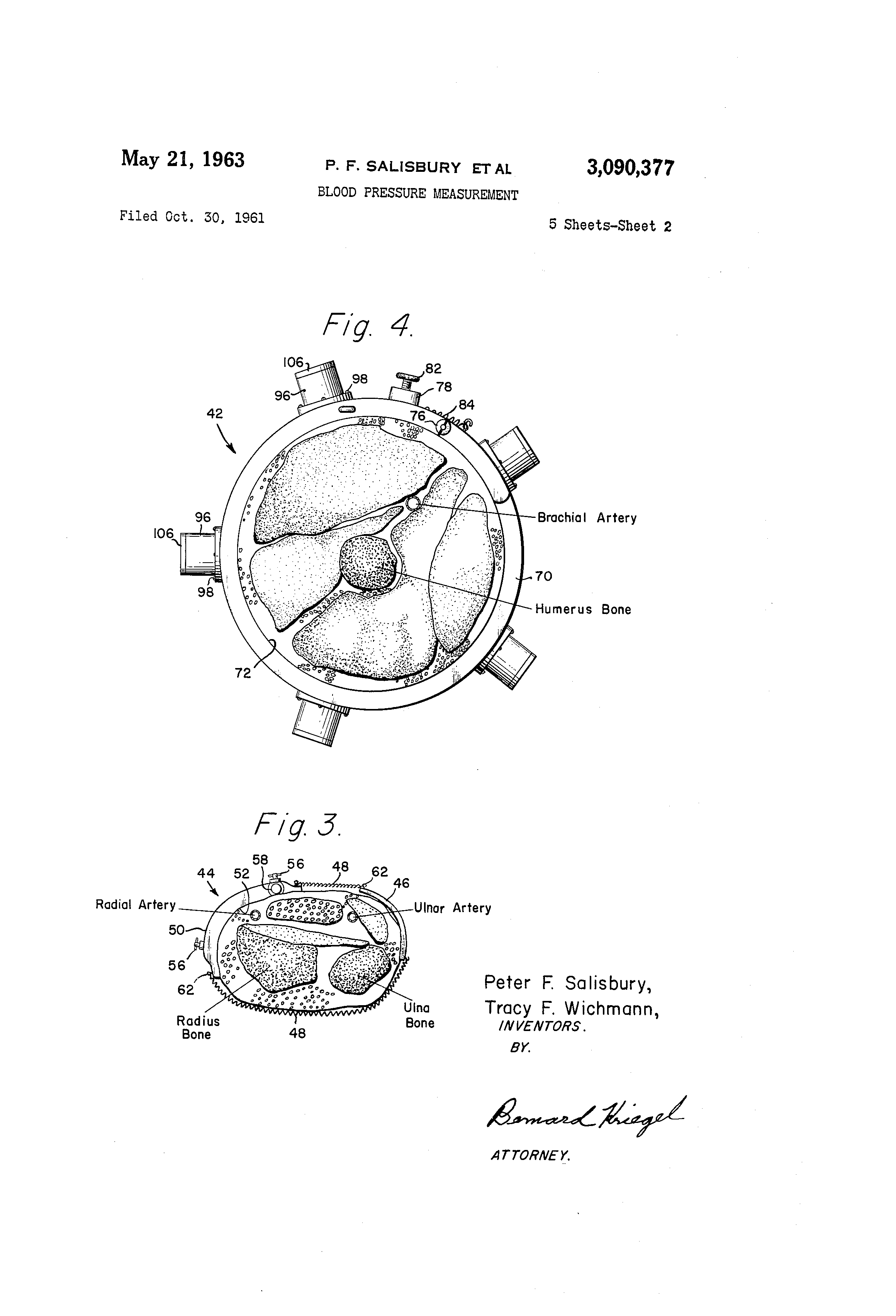 patent-us3090377-blood-pressure-measurement-google-patents