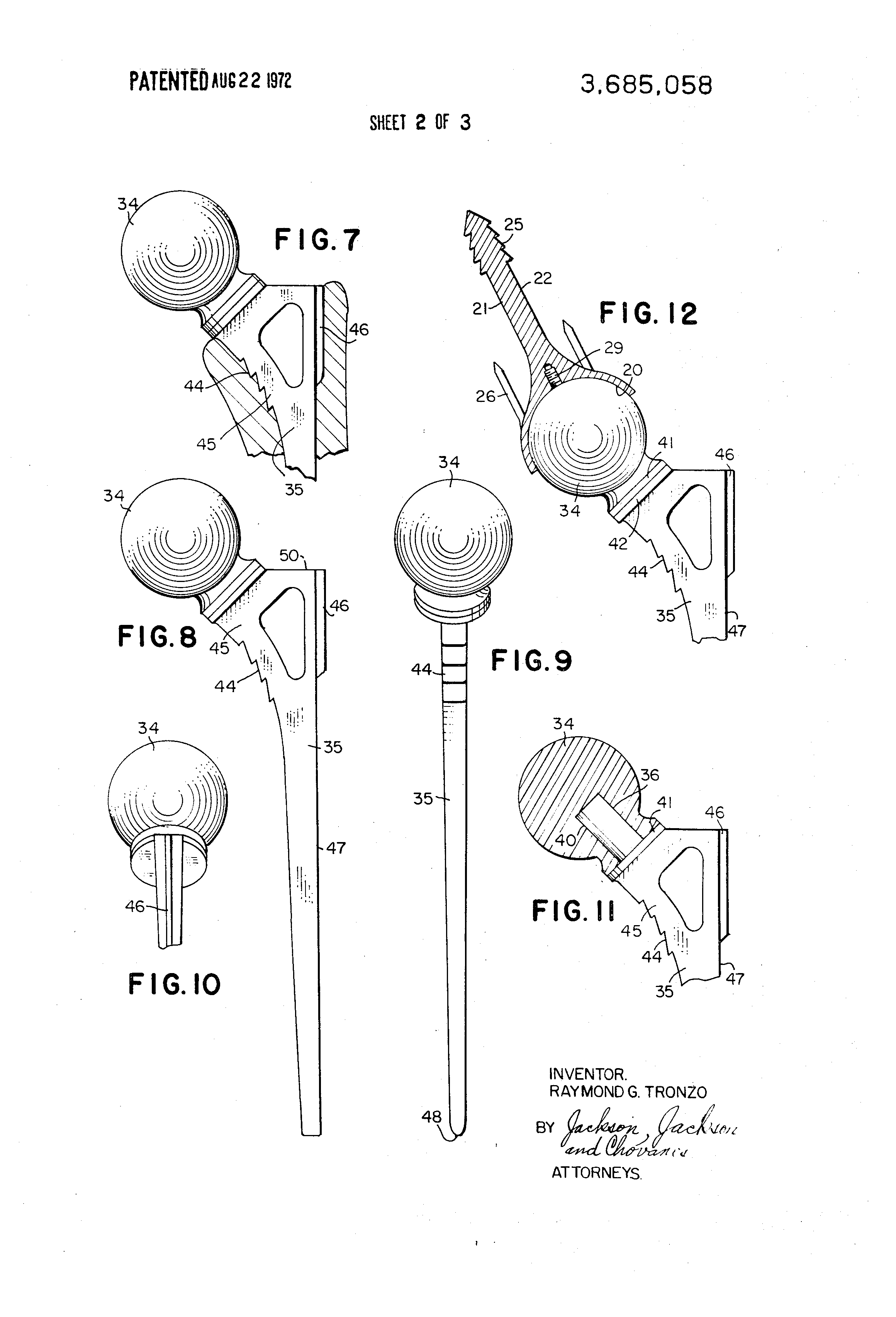 Patents Prosthetic Knee Sketch Coloring Page