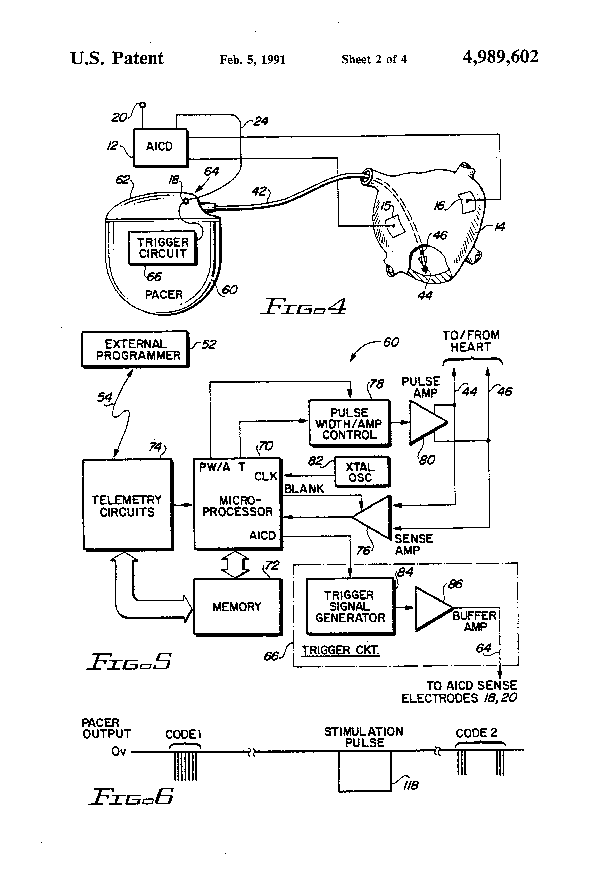 Patent US4989602 - Programmable automatic implantable cardioverter ...