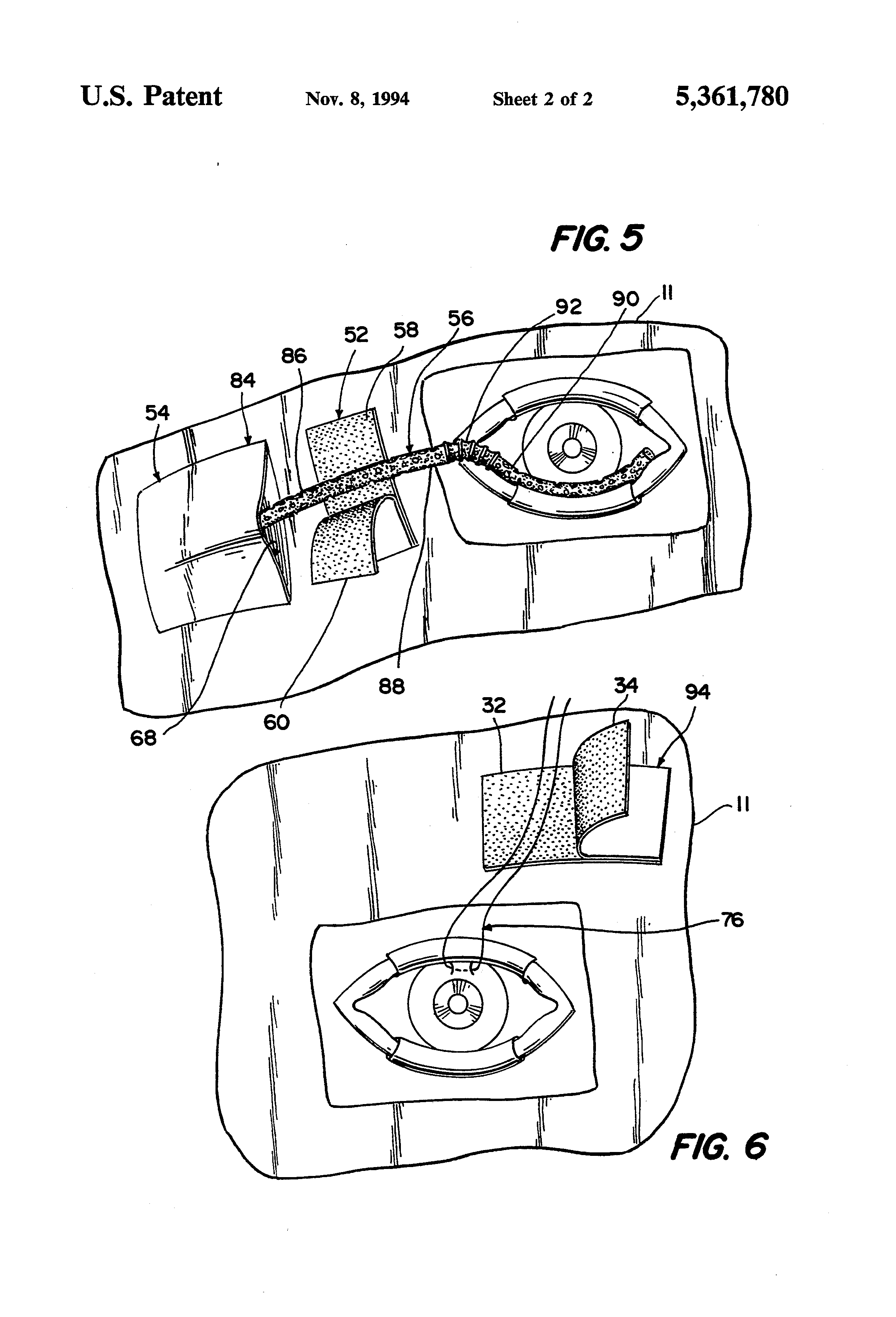 Patent US5361780 - Head stabilizer and superior rectus bridle suture ...