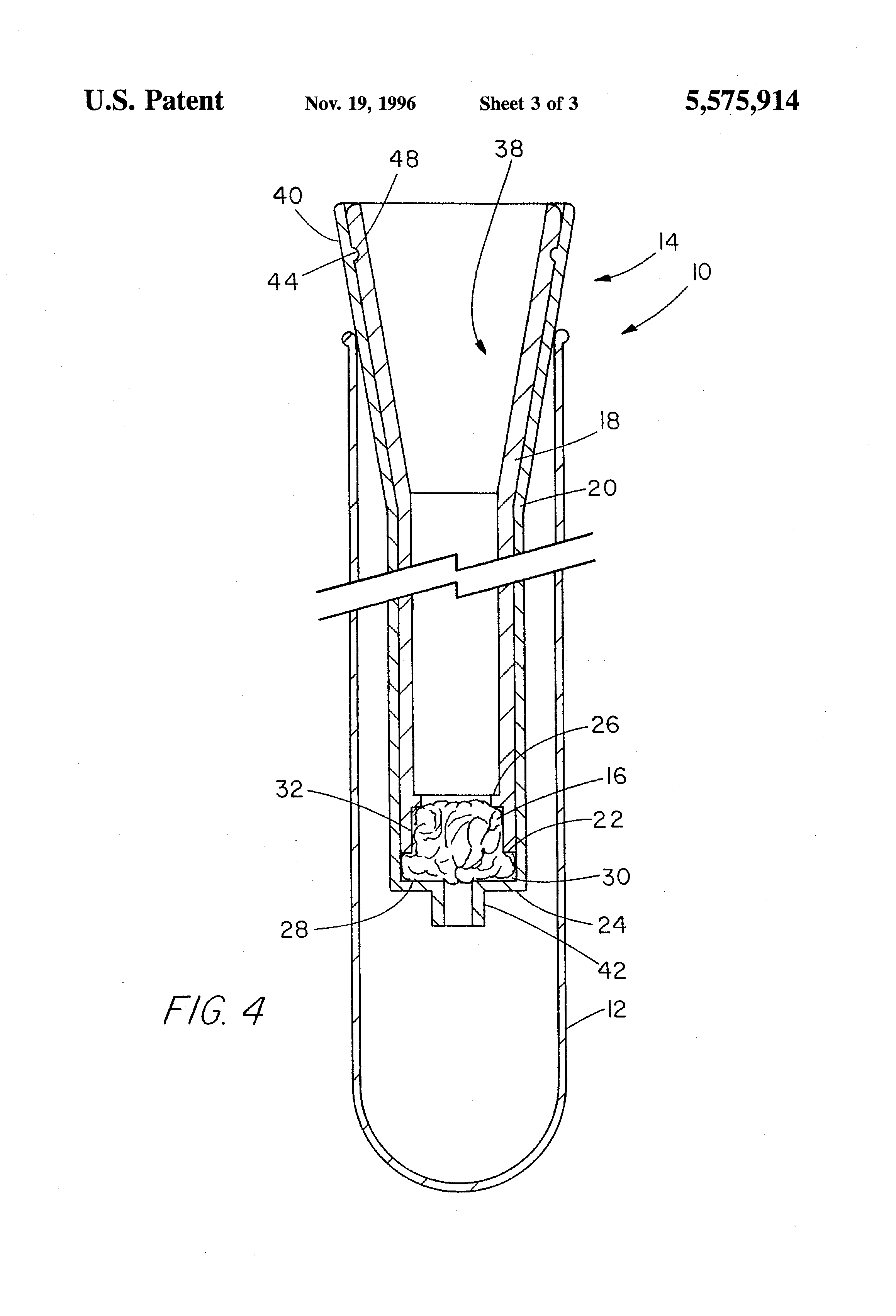 Patent US5575914 - Sperm filter trap having compressed glass wool ...